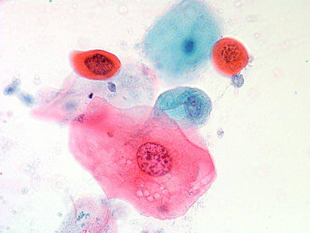 Eurocytology
