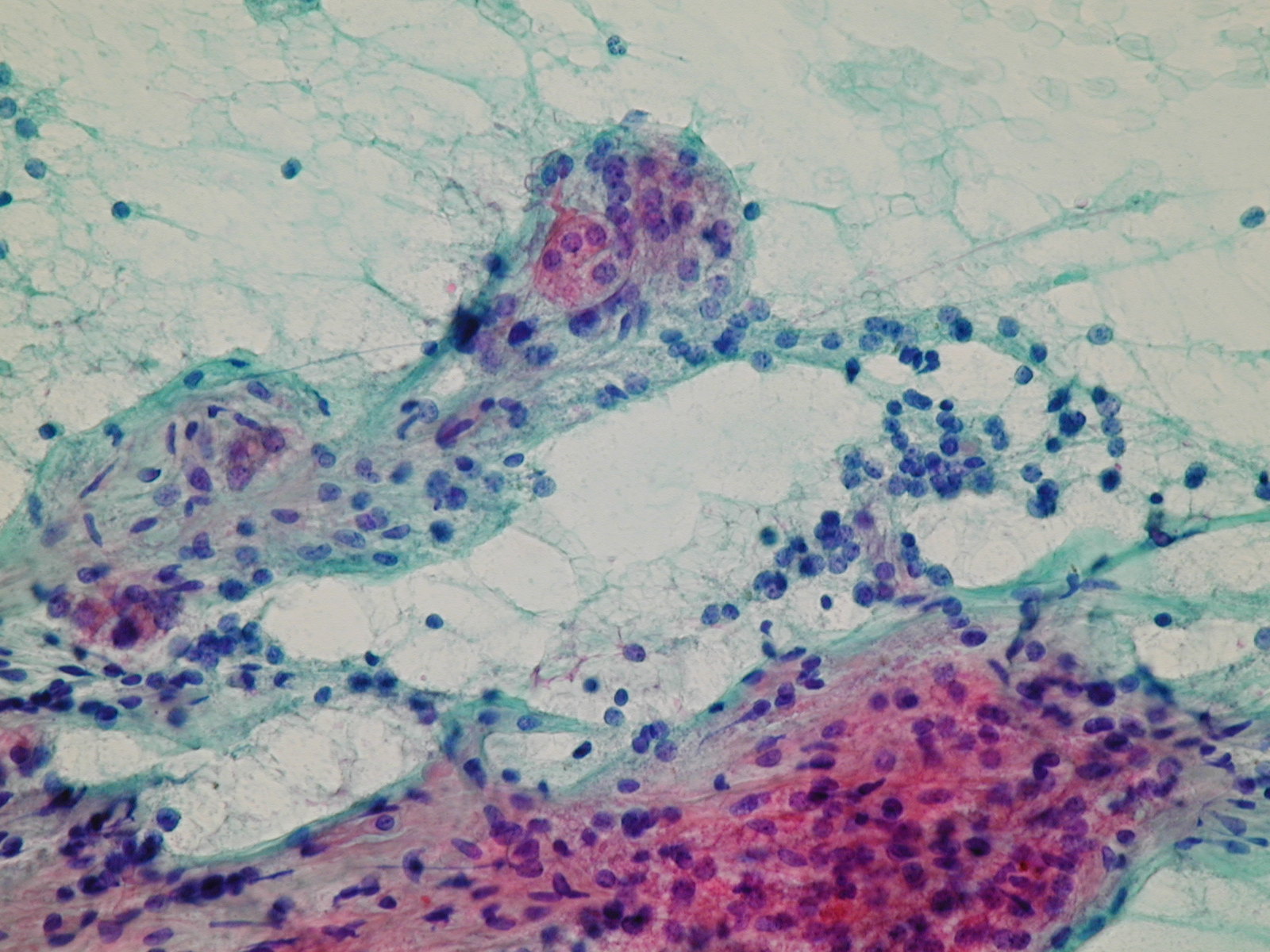 Eurocytology