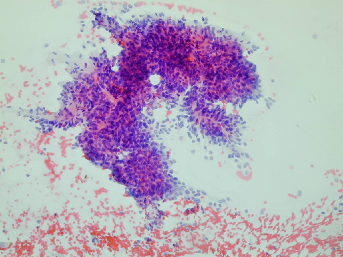 Eurocytology