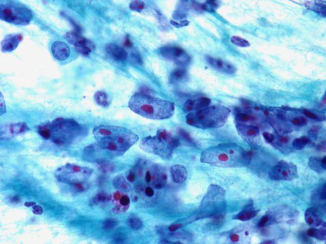 Eurocytology