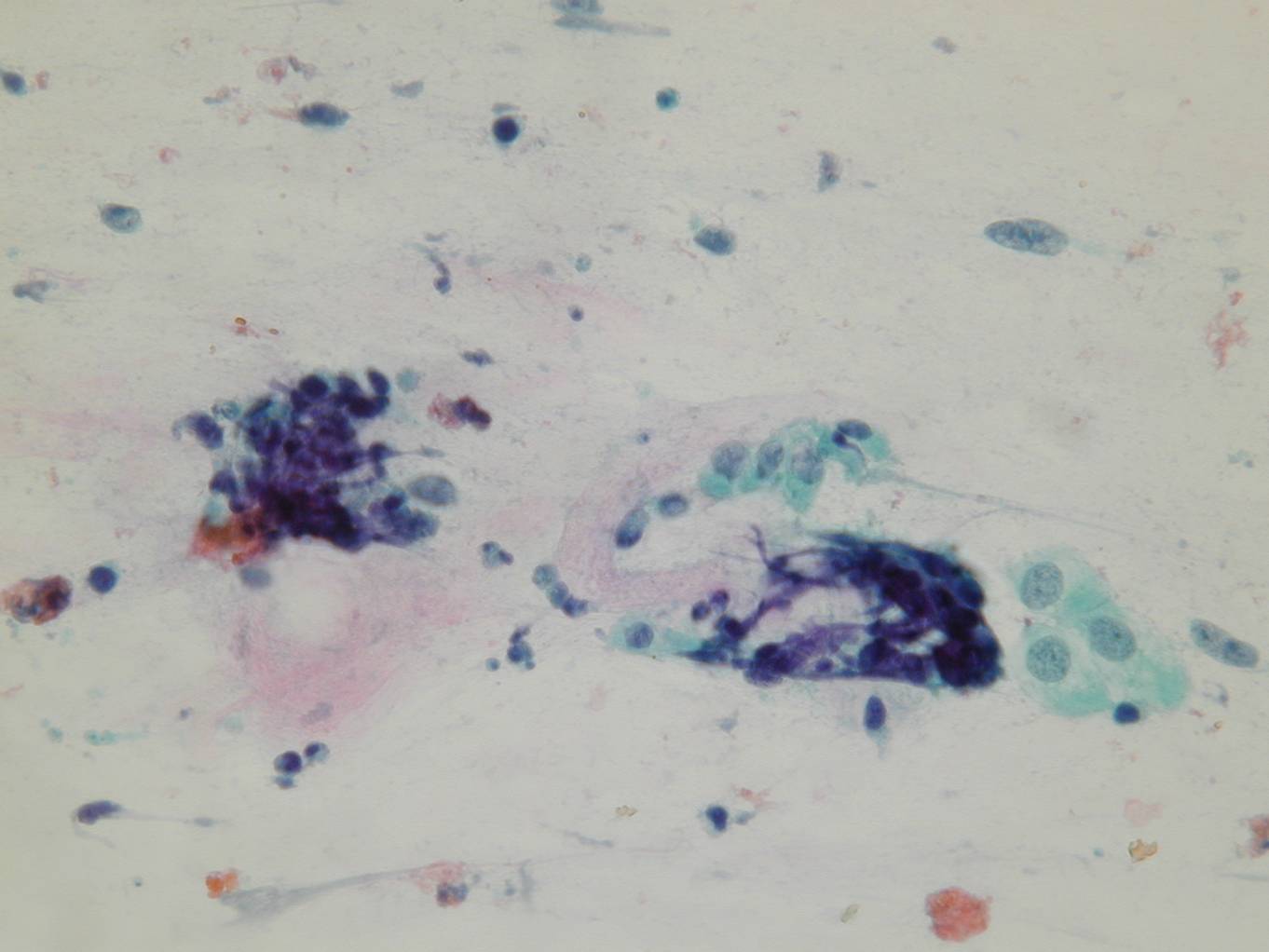 Eurocytology