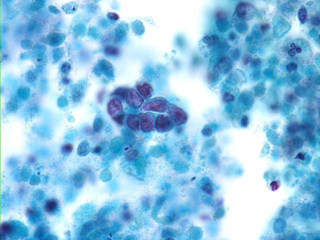 Eurocytology