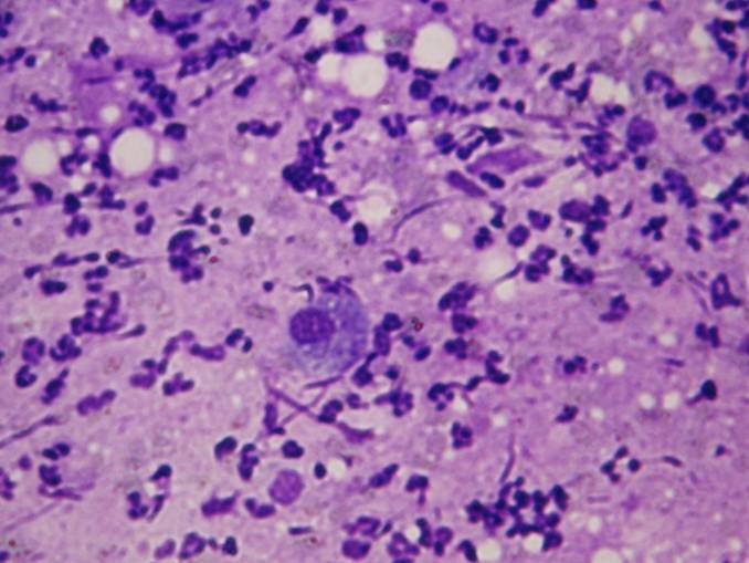 Eurocytology