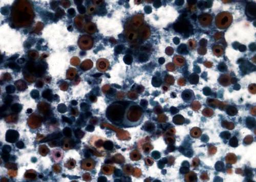 Eurocytology