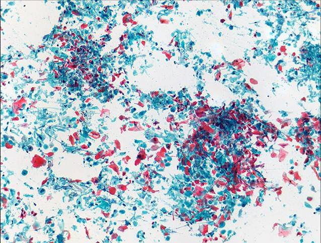 Eurocytology