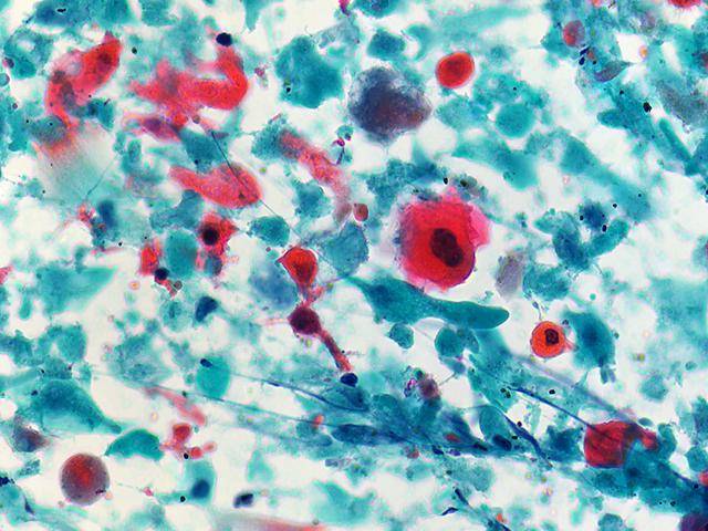 Eurocytology