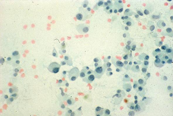 Eurocytology