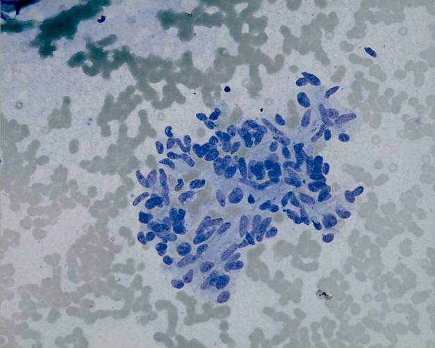 Eurocytology