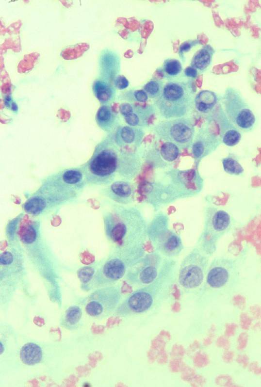 Eurocytology